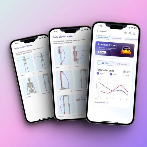 FlexiTrace Posture Analysis