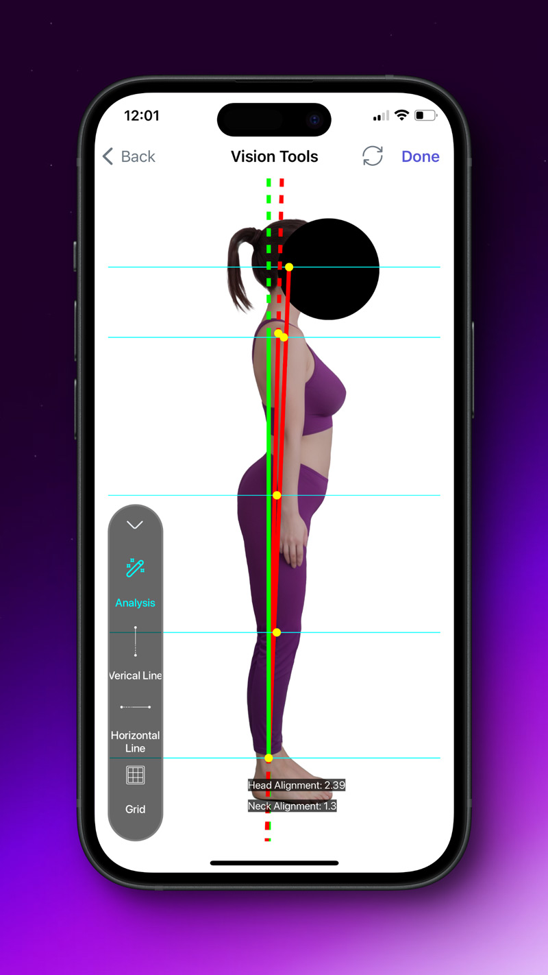 Hyperlordosis: Understanding & Managing Lumbar Curvature