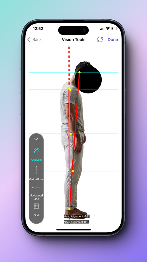 Forward Head Posture - How to Correct and Improve Neck Alignment