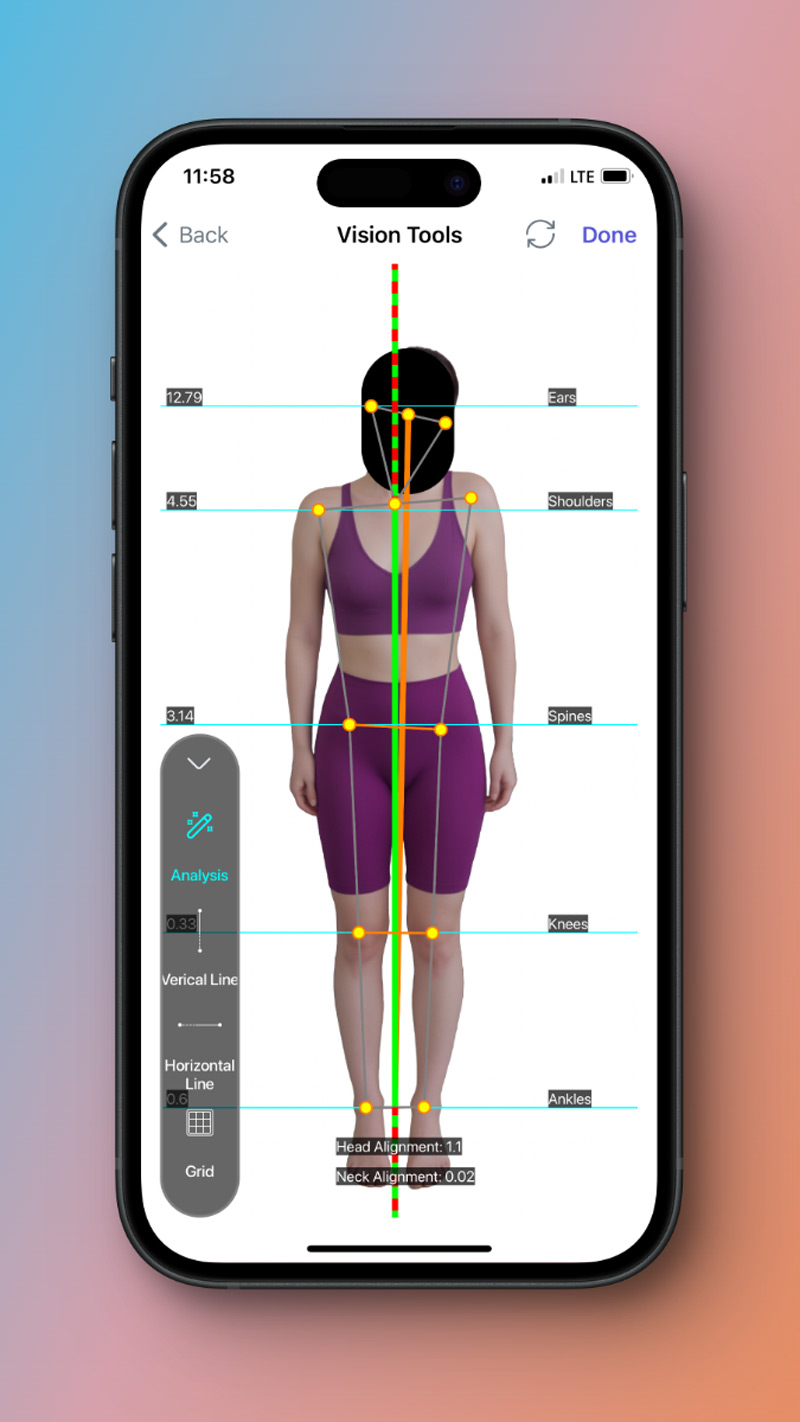 Torticollis Overview - FlexiTrace