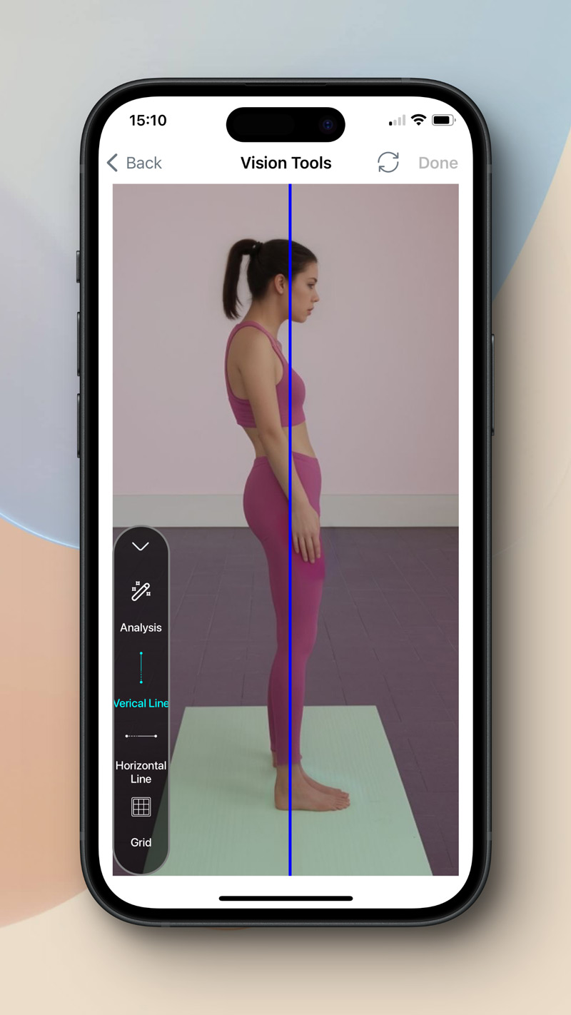 Sway Back Posture - FlexiTrace