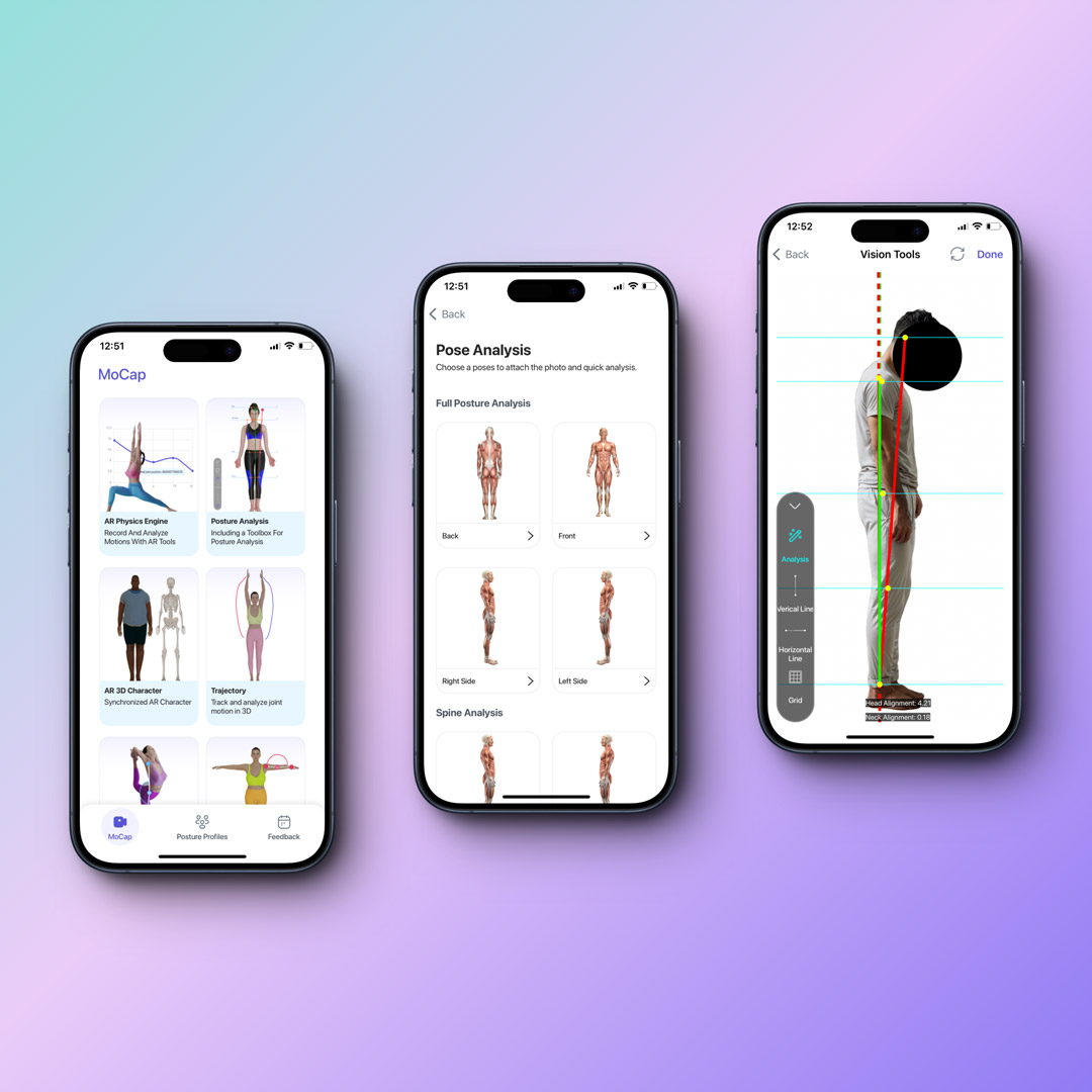 Forward Head Posture - How to Correct and Improve Neck Alignment