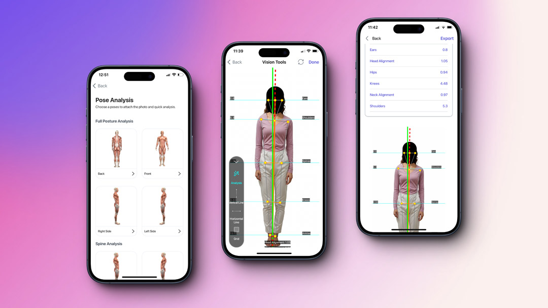 Uneven Shoulder Posture Analysis