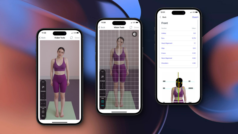 Torticollis Overview - FlexiTrace