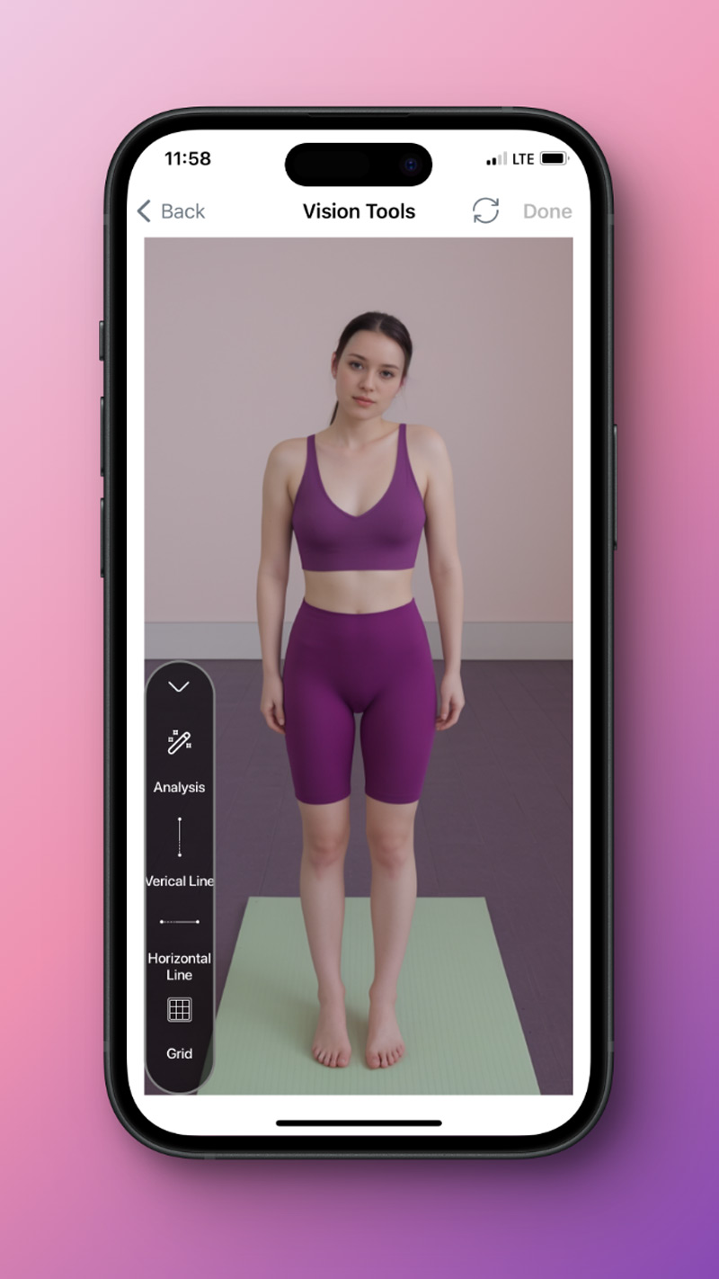 Torticollis Overview - FlexiTrace