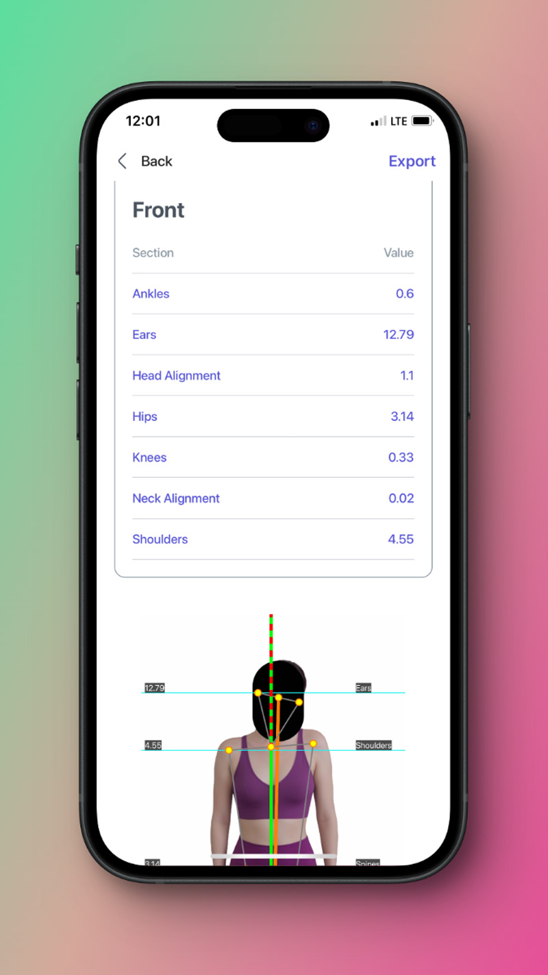 Torticollis Overview - FlexiTrace