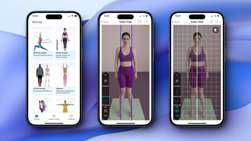 Knock Knees Detection and Correction with FlexiTrace