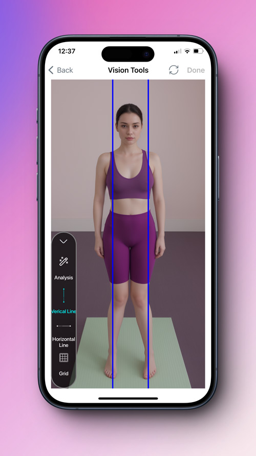 Knock Knees Detection and Correction with FlexiTrace