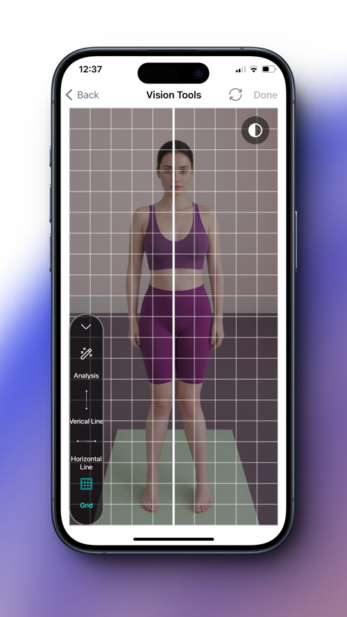 Knock Knees Detection and Correction with FlexiTrace